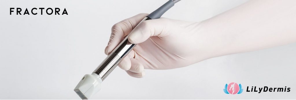 Fractora RF Fractional | LiLyDermis | Calgary